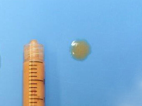 Lipofilling - ETHIANUM Klinik Heidelberg | Chirurgie auf höchstem Niveau